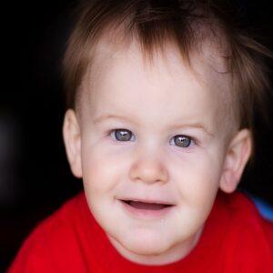 Palate Repair Surgery in Dubai & Abu Dhabi | Cleft Palate Surgery